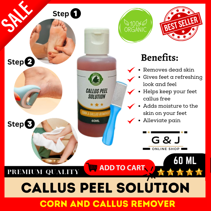 ⚡⚡CALLUS REMOVER SET 60ML KALYO OIL SOLUTION WITH CALLUS PILE GRINDER ...