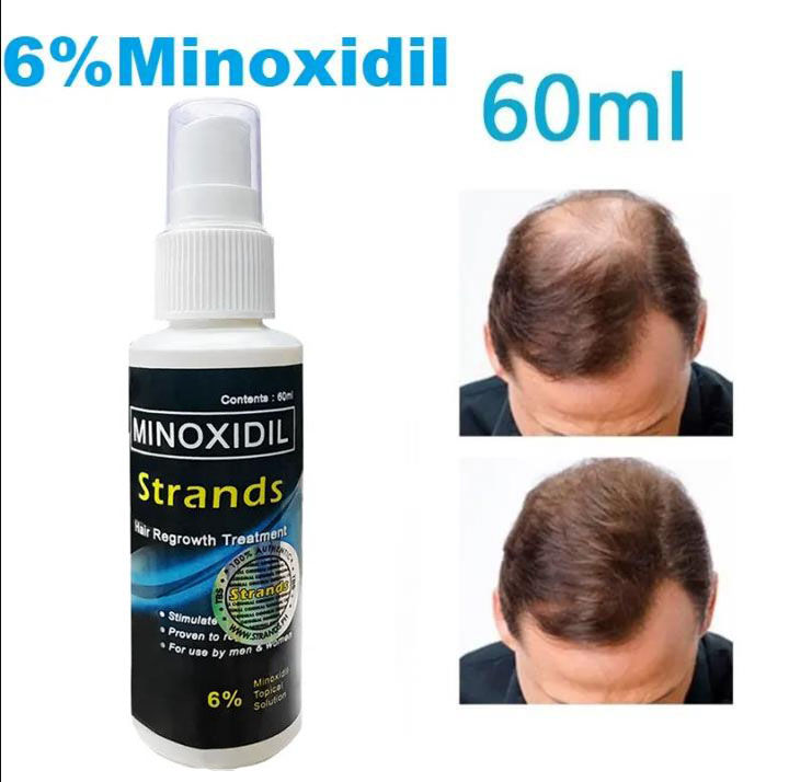 Minoxidil Strands 6% Minoxidil Topical Solution (60ml per bottle) Hair ...