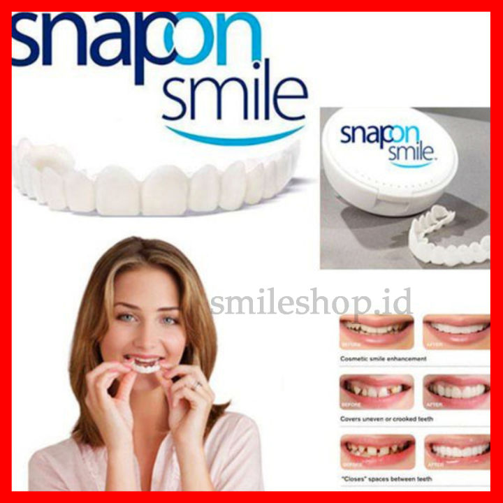 Snap On Smile 100% Original Authentic Gigi Palsu Snapon Smile 1 Set Veneer Gigi Palsu XX150 ...