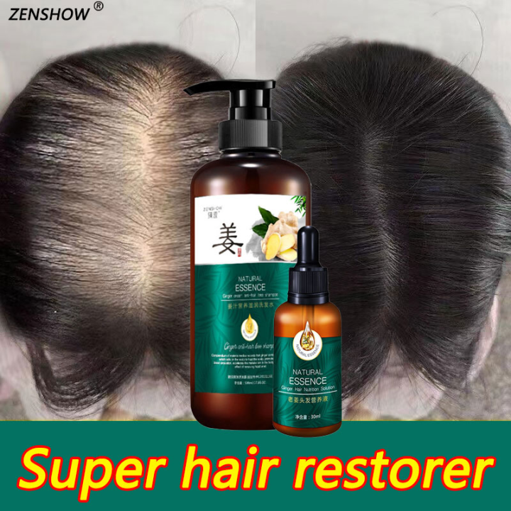 100% Original Natural Ginger Shampoo for Hair Loss Herbal Ginger ...