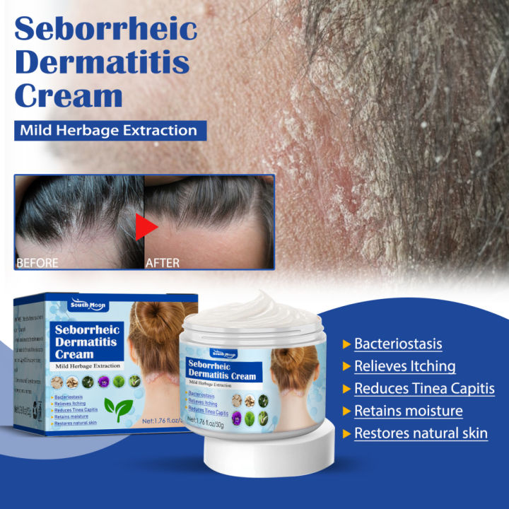 HANBI 批发现货 Southmoon Seborrheic Dermatitis Cream Antibacterial Cream ...
