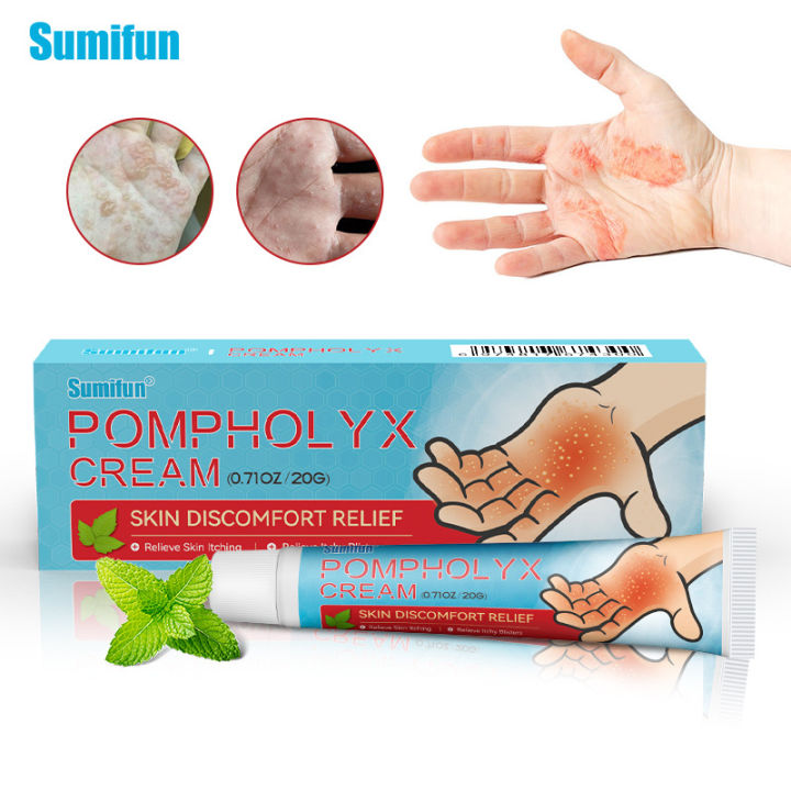 Sumifun Original Sumifun 20g Herbal Ingredients Pompholyx Cream For