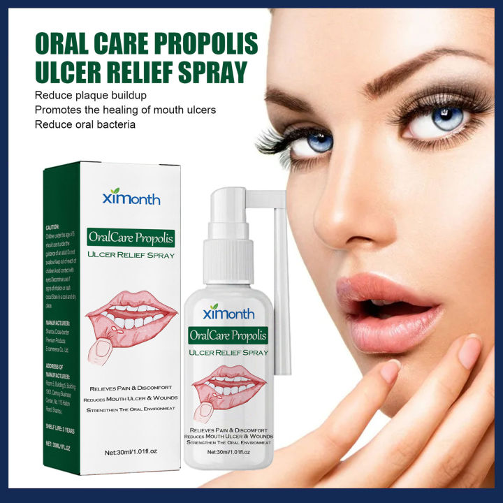 XiMonth Oral Care Propolis Ulcer Relief Spray Relieve Chapped Lips ...