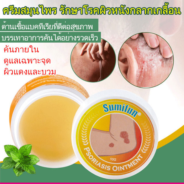 ttpr Psoriasis Cream for Itchy Skin on Hands and Feet | Lazada PH