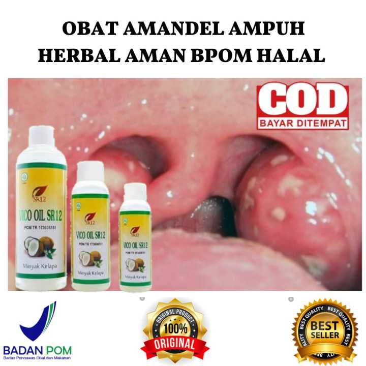 OBAT AMANDEL AMPUH HERBAL || OBAT AMANDEL DEWASA DAN ANAK || OBAT ...
