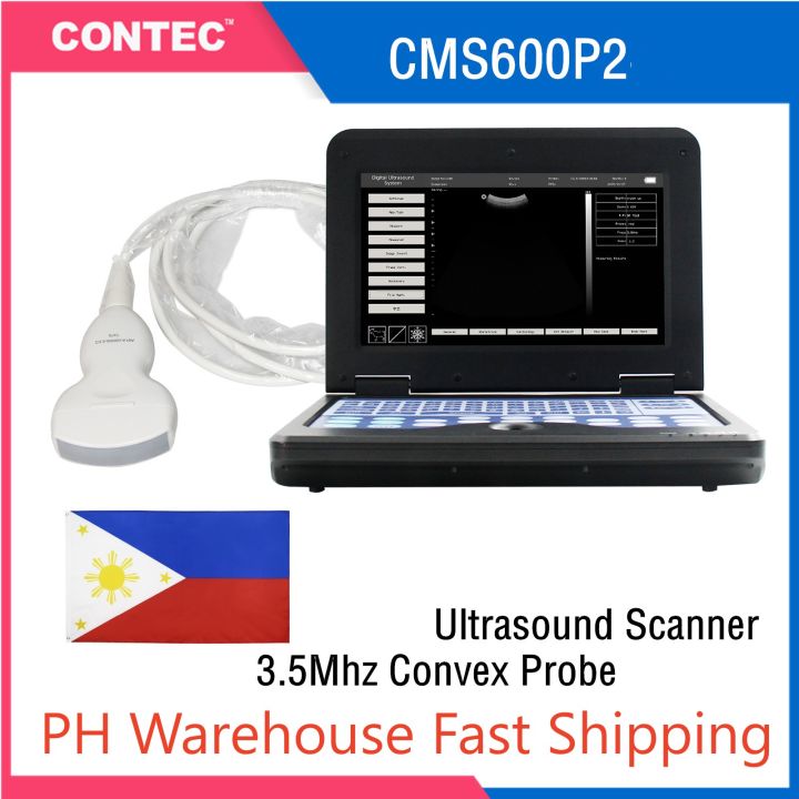 PH Warehouse CONTEC CMS600P2 Portable Laptop Machine Digital Ultrasound ...
