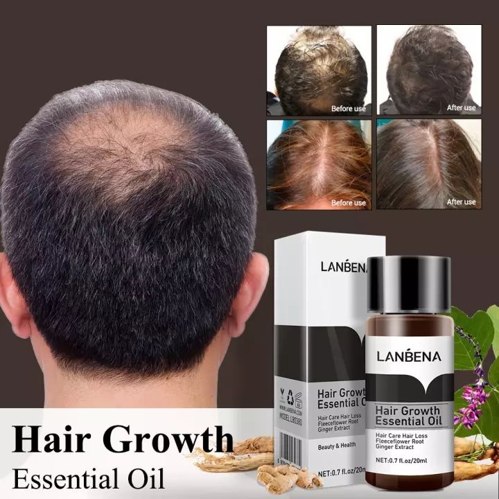 Lanbena Hair Growth Essential Oil Hair Loss Treatment Prevent Baldness