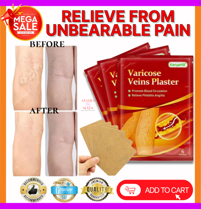 EFFECTIVE!! VARICOSE PLASTER Fast Delivery 6pcs/12pcs/18pcs | Varicose ...