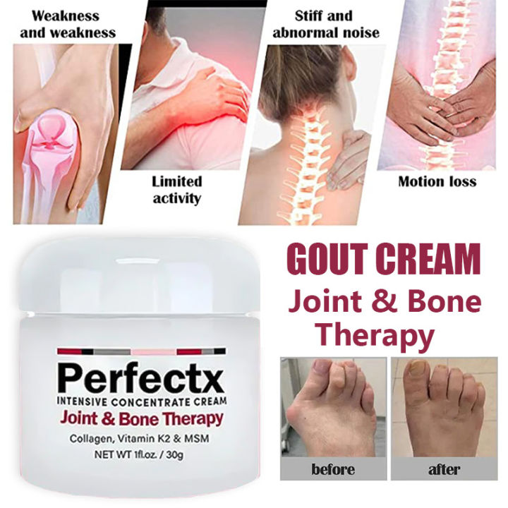 Perfectx Joint And Bone Therapy Cream 30g Intensive Concentrate Cream ...