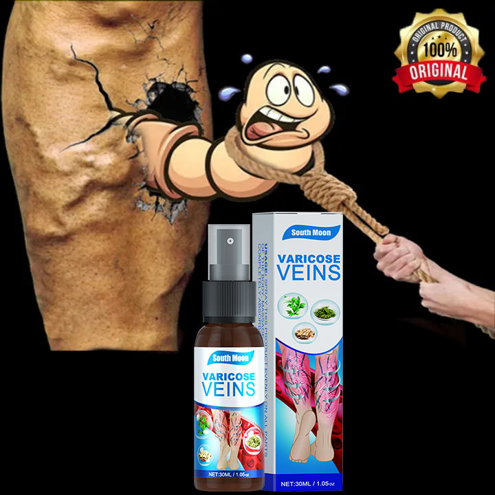 Varicose Vein Spray Varicose Veins Remover Effective Original In The ...