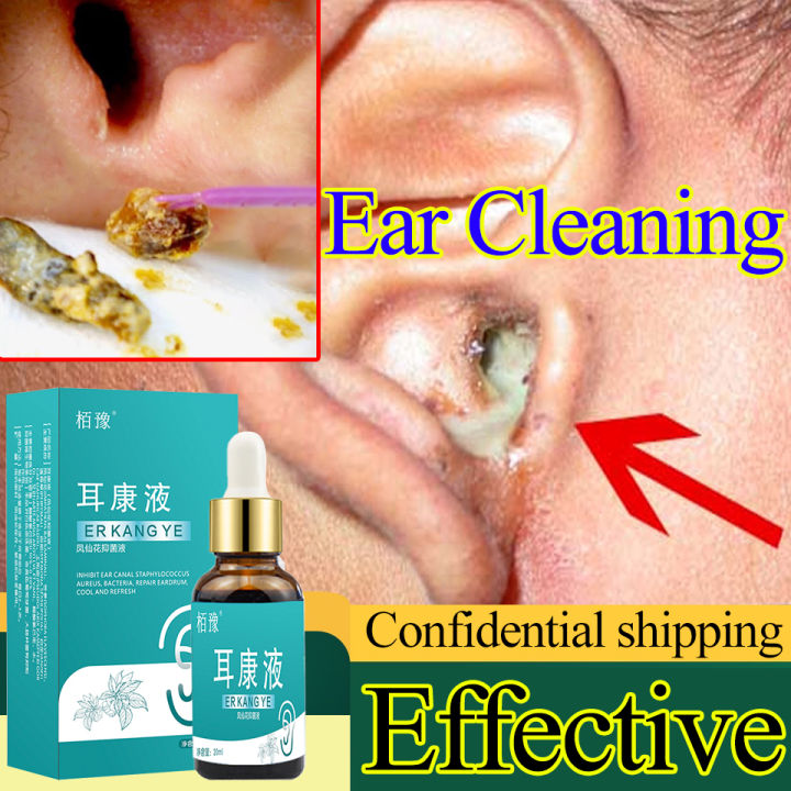Ear Drop Natural Chinese Herbal Acute Otitis Ear Drops 20ml tinnitus ...