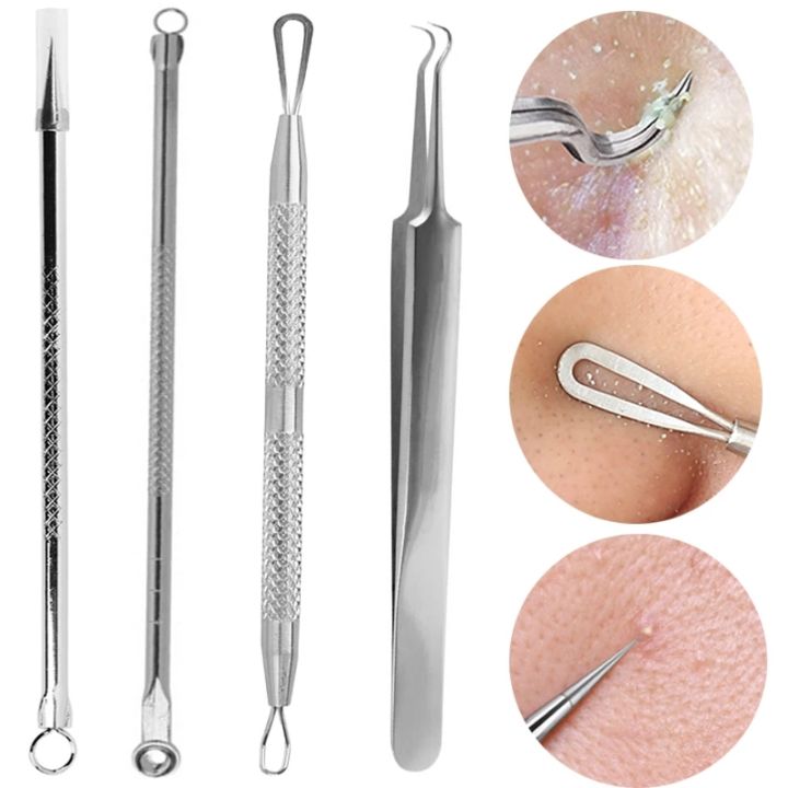 WOOLOVE Stainless Steel Blackhead Acne Removal Needles Facial Skin Care ...