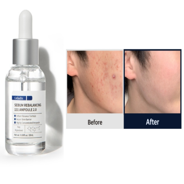Celladix Korea Top Selling Sebum Rebalancing 131 Ampoule 20ml | Lazada ...