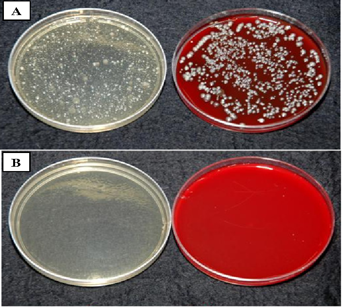 Plate Count Agar (PCA) 160 gram Microbiology Diagnostic Reagent | Lazada