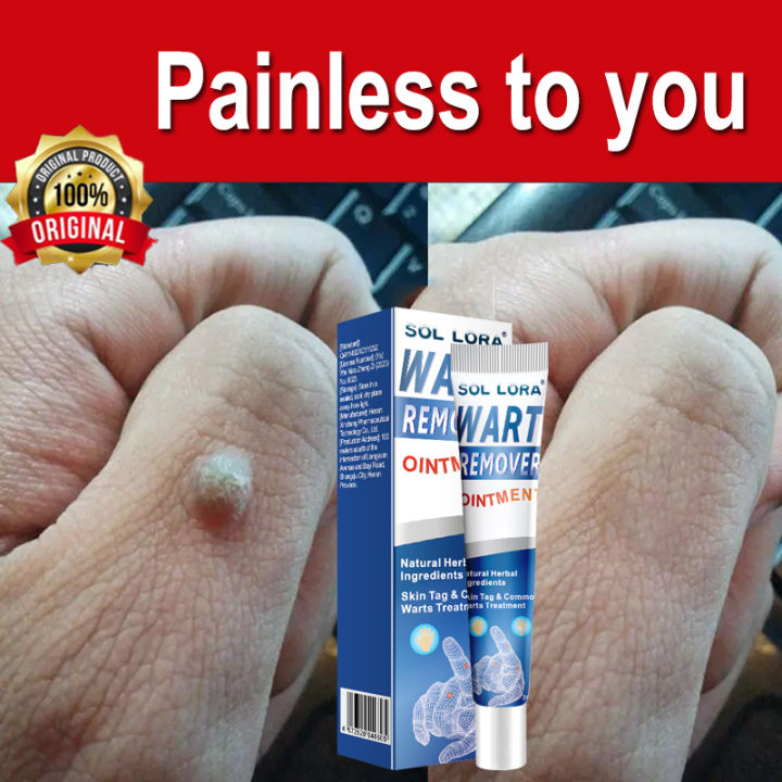 Warts Remover Original Cream 20g Painless Warts Magic Remover Wartz ...