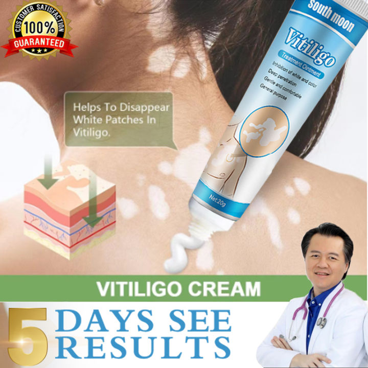 vitiligo skin treatment cream Vitiligo remover white spot removal cream ...