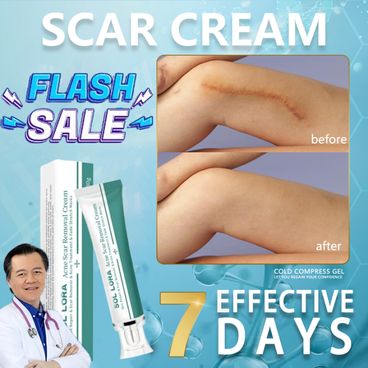 sol Lora scar remover cream 100% epektibo sa pagtanggal ng mga peklat ...