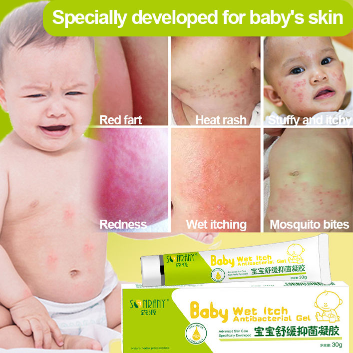 Baby/Kids Eczema Anti-itch Soothing cream For children Itchy Skin And ...