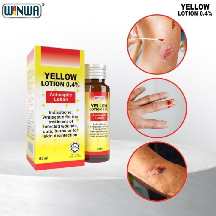 WW YELLOW LOTION ANTISEPTIC LOTION 30ml / 60ml 黄药水消毒剂 | Lazada