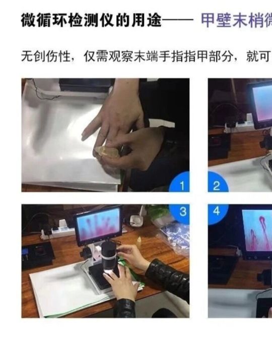 High-definition non-invasive microcirculation detector xw880m ...