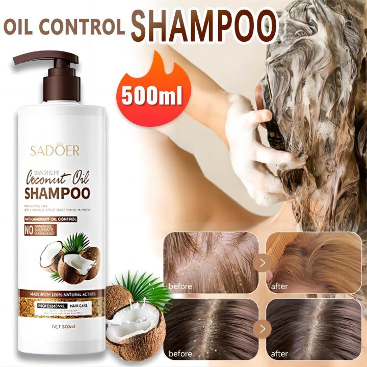 Coconut Shampoo Anti-Dandruff Repair Damage Hair Dry Hair Care Control Oil Shampoo 500ml | Lazada PH