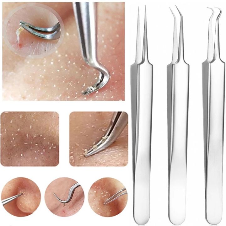 Stainless Steel Facial Acne Blackhead Remover Needles Extractor Pimple ...