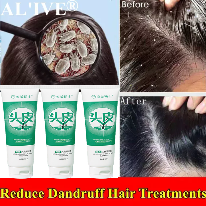 Scalp cleansing shampoo effectively solves dandruff itchy scalp ...