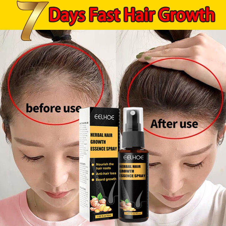 Hair Grower Spray For Men Original Minoxidil Hair Growth 10 X Faster