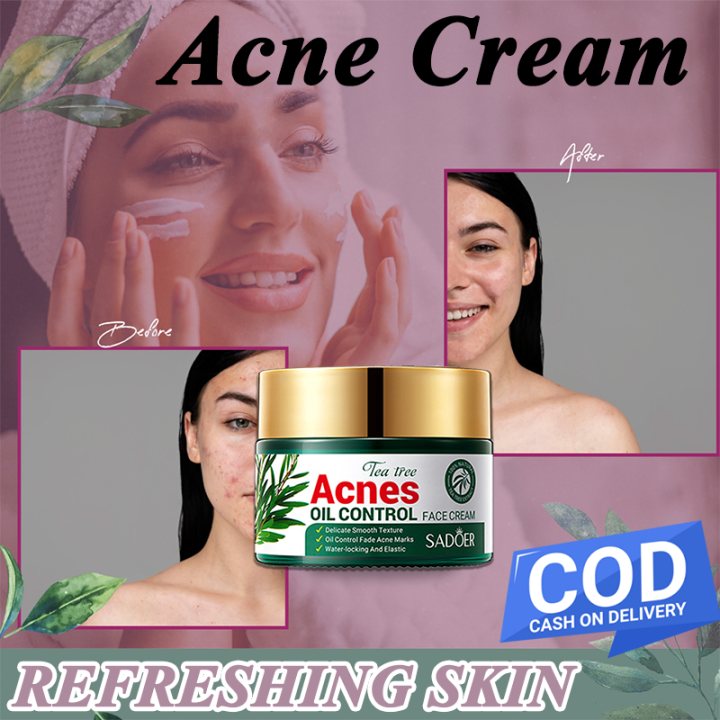 99% Pimples Remover Effective Fades Acne Marks Repairs Acne Skin Care ...