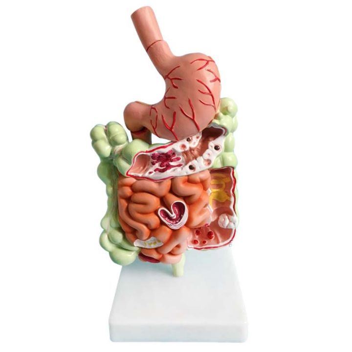 Human Digestive System Model Stomach Anatomy Large Intestine Cecum ...