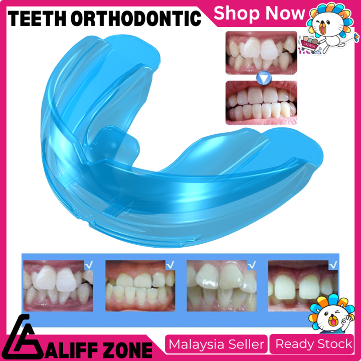 💥Best Smile💥 Perapat Gigi Blue Tooth Teeth Orthodontic Appliance ...