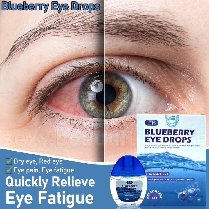 Blueberry Eye Drops Itchy Relieves Dry Eyes Sore Red Eyes Discomfort ...
