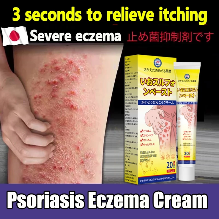 Natural Herbal Sulfur Itch Relief Cream 20g | Centella + Green Tea ...