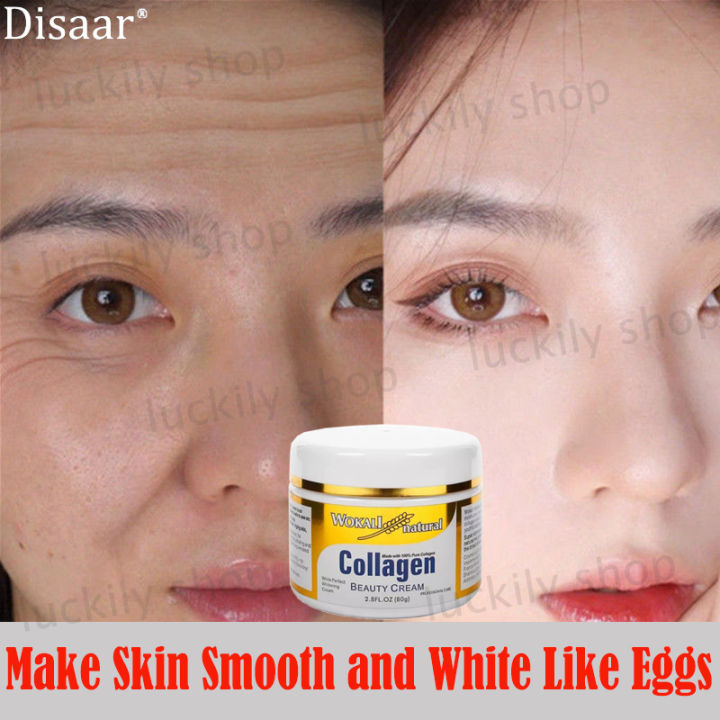 DISAAR Collagen Cream 80g Face Cream Lighten Dark Spots Repair Damaged ...