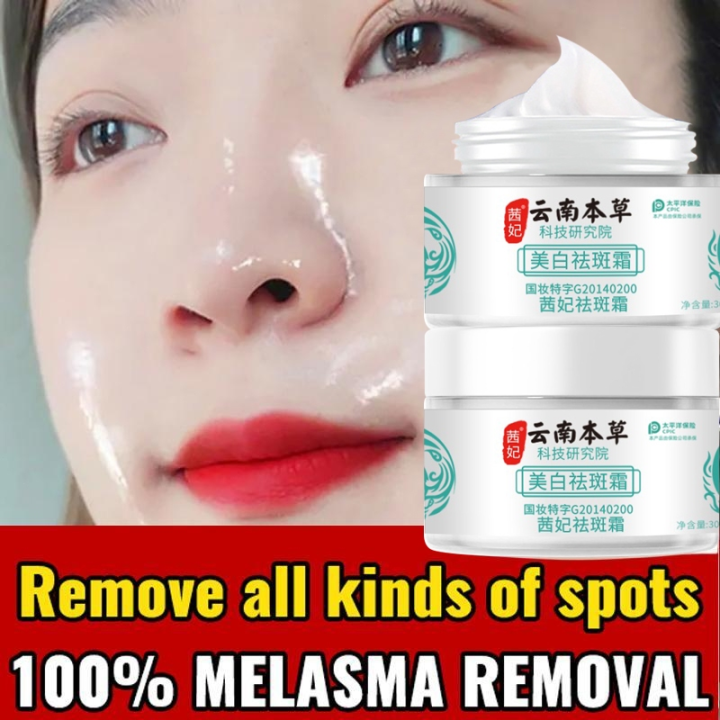 JAPANESE MELASMA PEKAS Remover Yunnan Herbal Cream White Spot Cream 30g ...