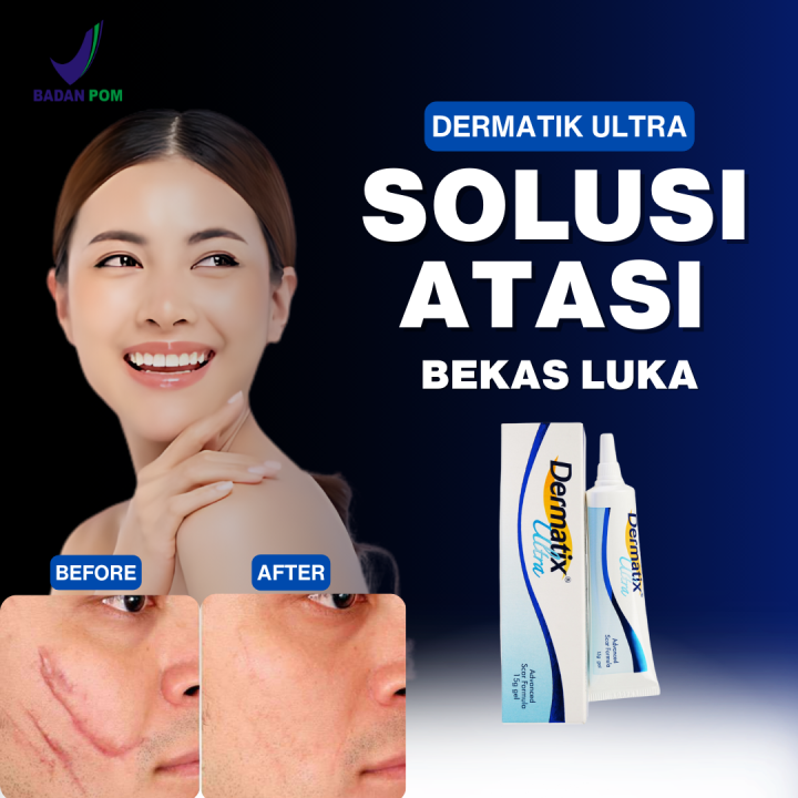 Dermatix Ultra Salep Obat Bekas Luka Bisa Dermatik Untuk Flek ...