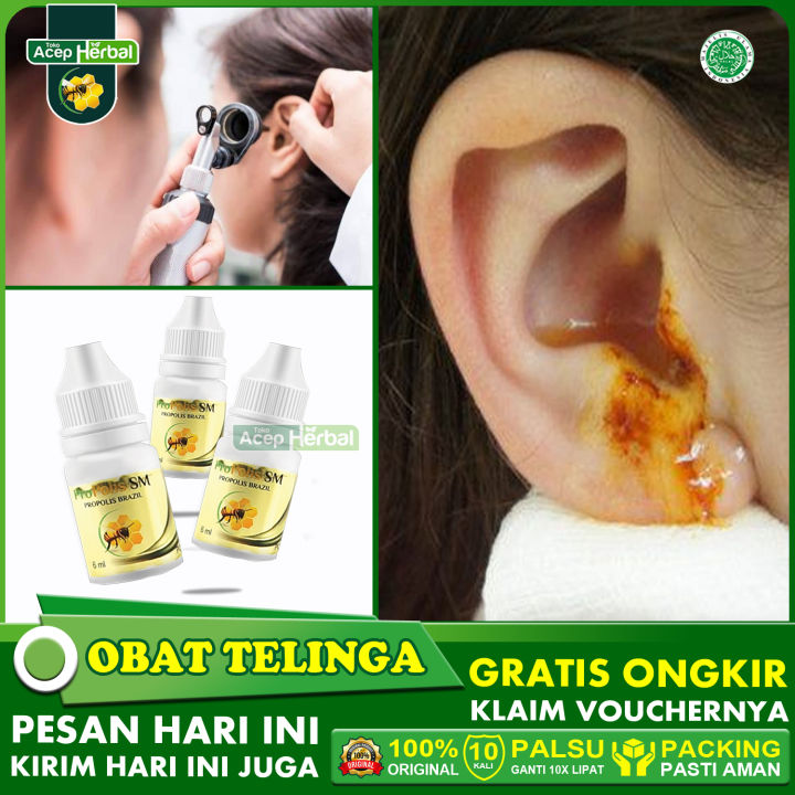 Obat Telinga Curek Berair dan Bau Telinga Bernanah Bau Infeksi Telinga ...