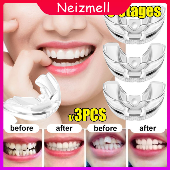 【1 Set/3pcs】 Phase 1-3 4D Invisible Teeth Orthodontic Aligner ...