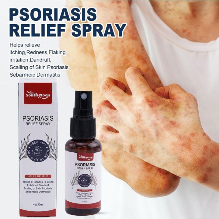 1/2/3PCS 30ml Psoriasis Relief Spray Hand Foot Scalp Eczema Relief ...