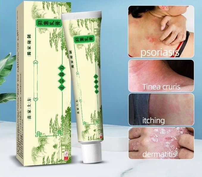 Herbal Medicine Psoriasis Eczema Ointment Dermatitis Skin Rash Cream ...