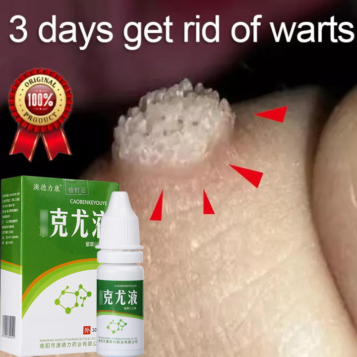 Warts Remover Original Gram wart liquid Warts Magic Remover Wart ...