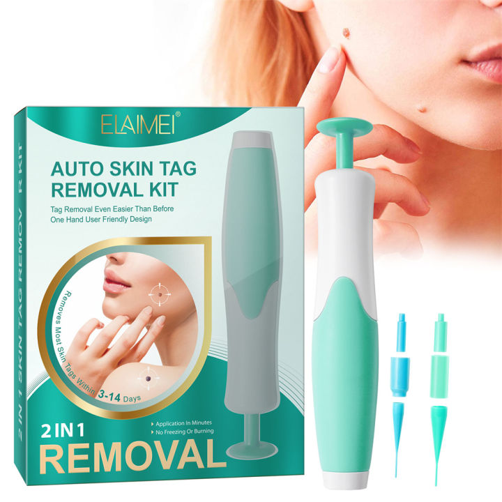 Elaimei Auto Skin Tag Remover Kit Skin Tag Removal Device Wart Removal ...