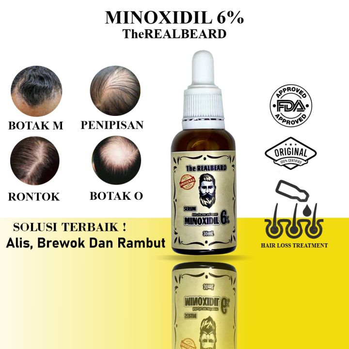 Minoxidil Penumbuh Rambut Brewok Alis, Botak M, Rambut Rontok, Karena ...