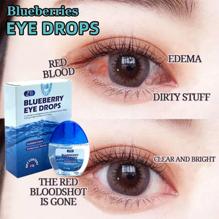 Original Blueberries Eye Drops for Clear Vision Dry Eyes Congestion ...
