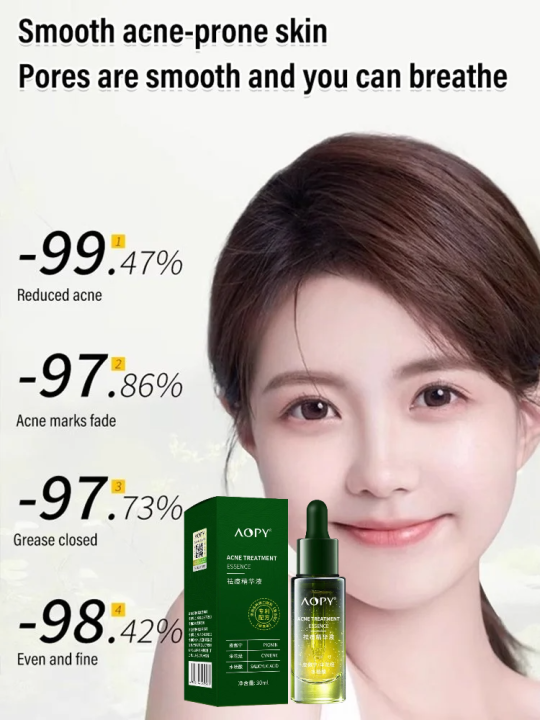 Original Essence Sensitive Skin Oil Fading Acne Marks Essence | Lazada PH