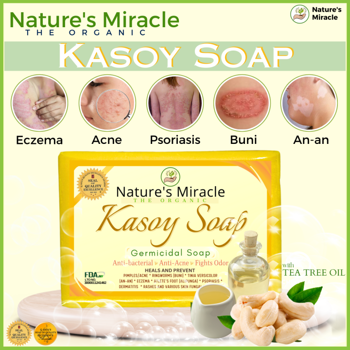 Kasoy Soap Original Acne Pimple Remover Eczema Remover Psoriasis Remover An-an Buni Kati Kati Sa ...