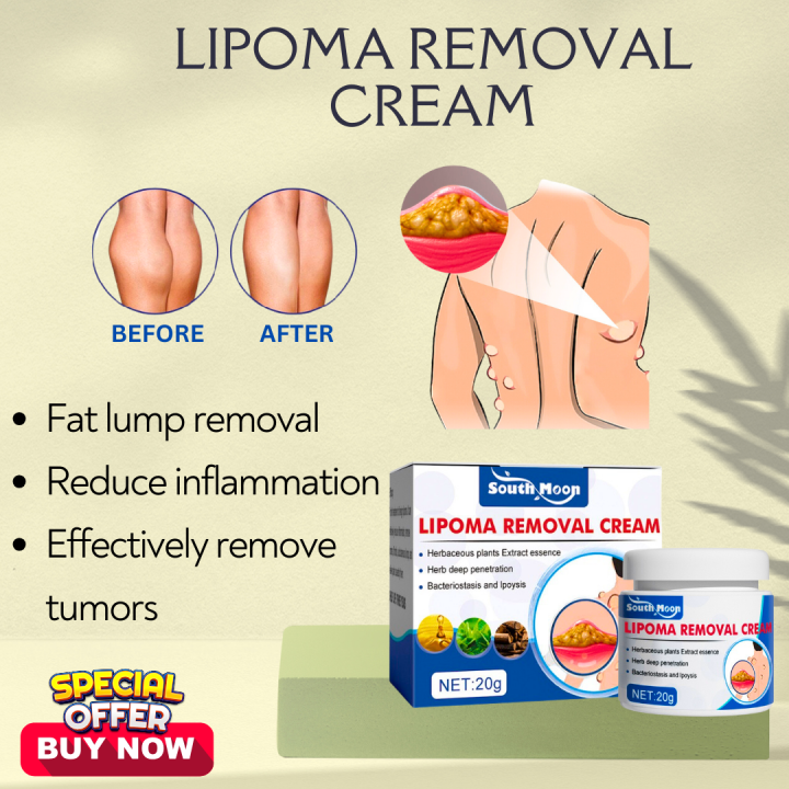 Lipoma Cream - Effective Remedy for tumor Removal, Skin Swelling ...