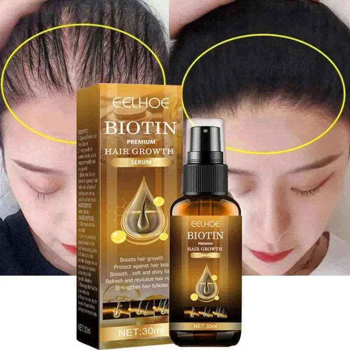 Biotin Fast Hair Growth Products Anti Hair Loss Serum Spray Prevent ...