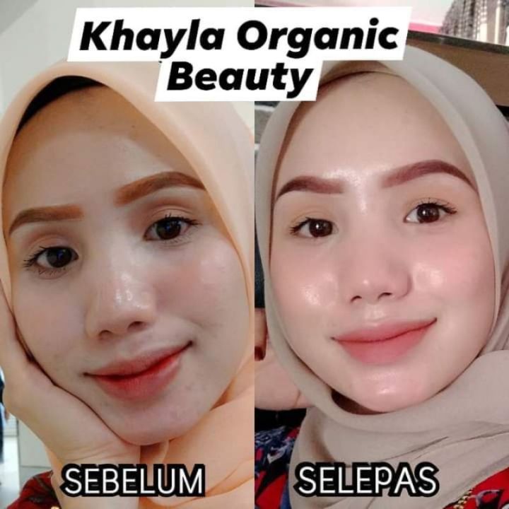 Khayla Serum Botox Produk 100% Original By Waniestieka | Lazada