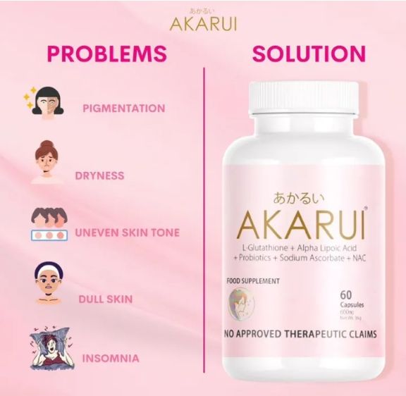 AKARUI Japan Whitening Glutathione 60 Capsules With Vitamin C & COQ10 ...